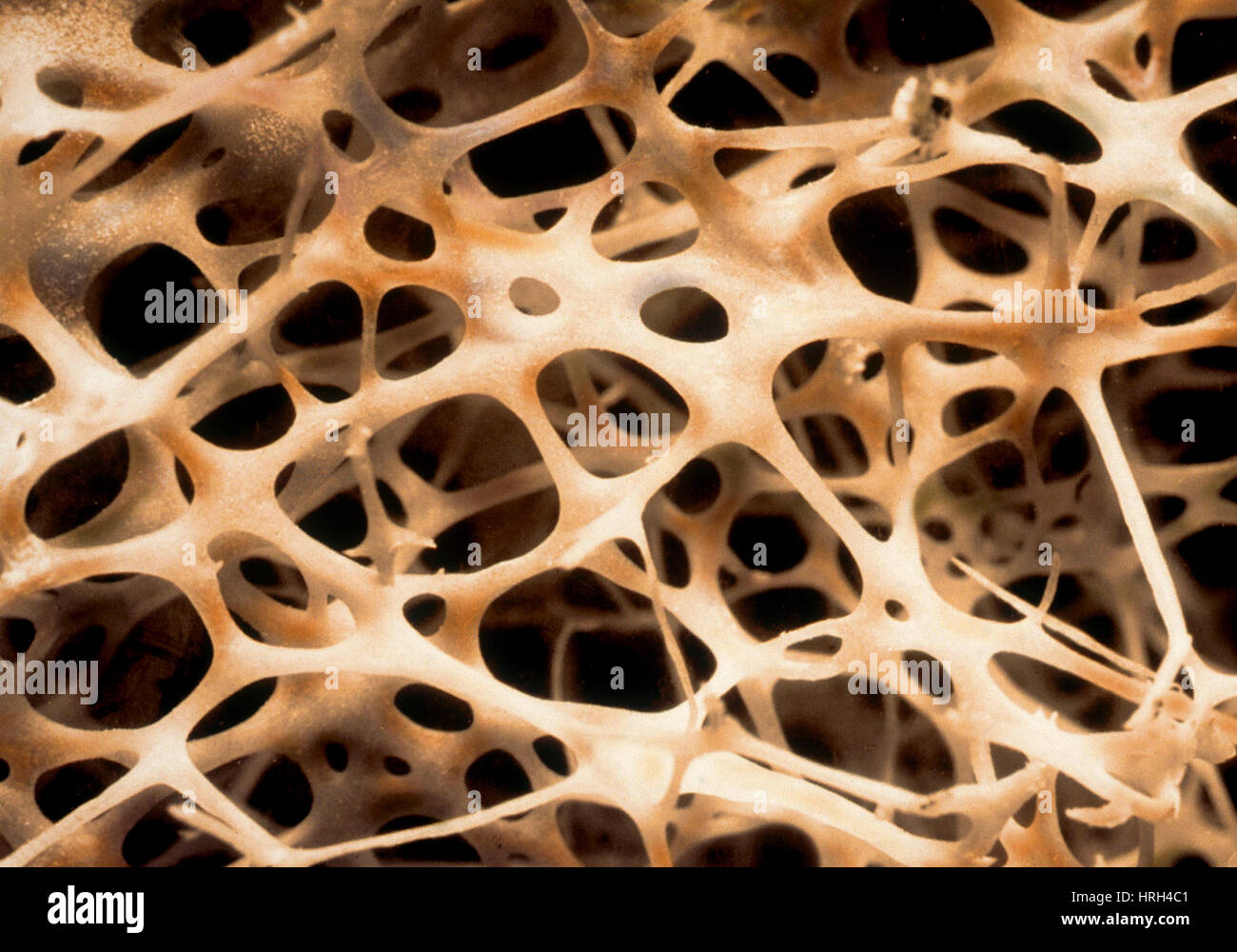 Human shin bone hi-res stock photography and images - Alamy