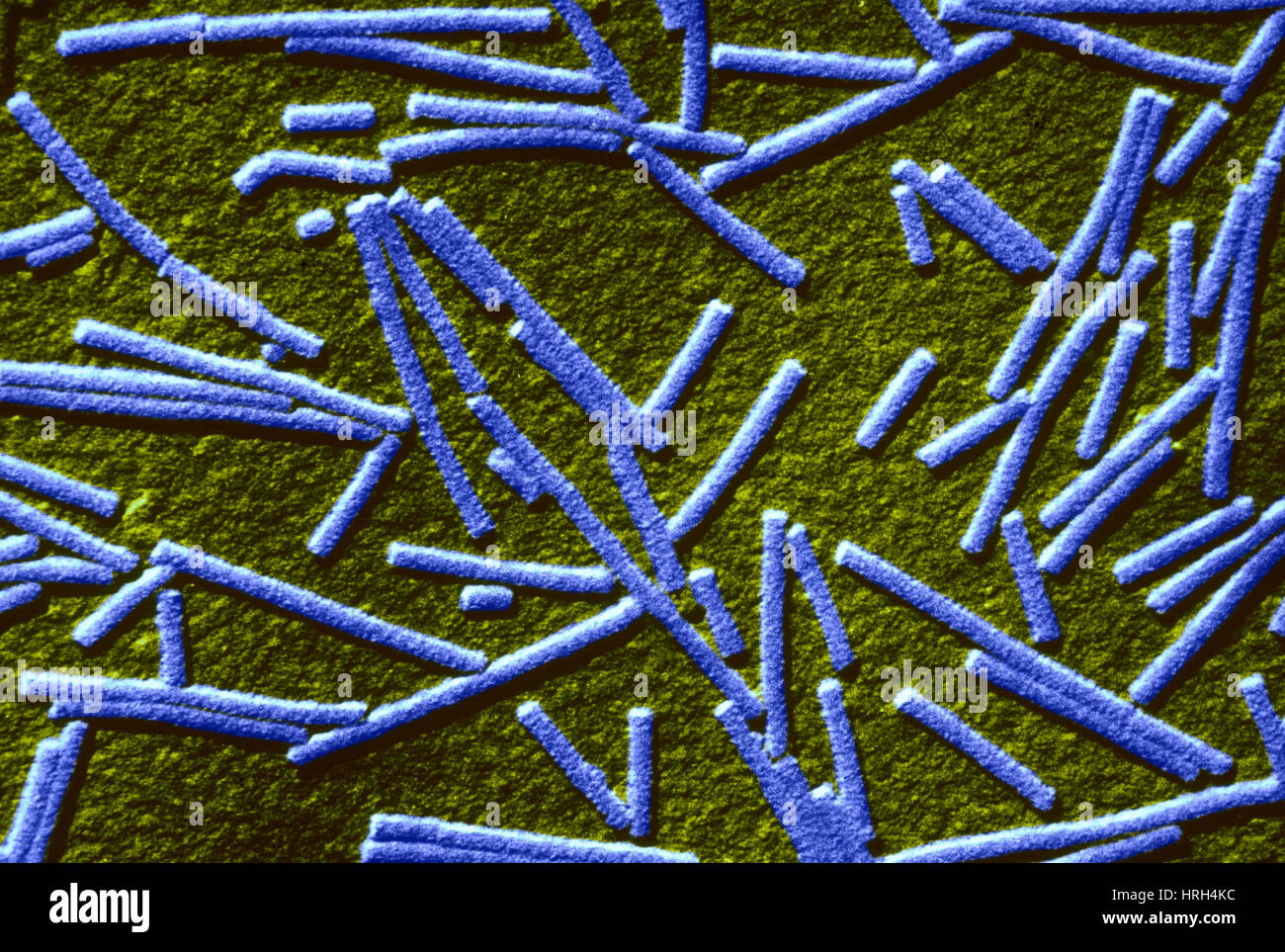 Tmv hi-res stock photography and images - Alamy