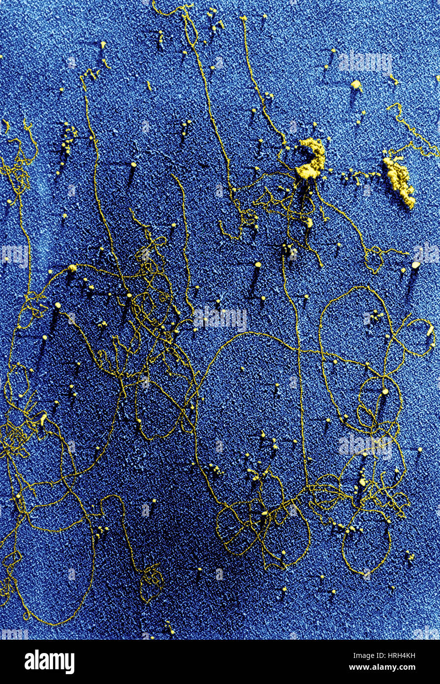 Transmission electron micrograph chloroplast hi-res stock photography ...