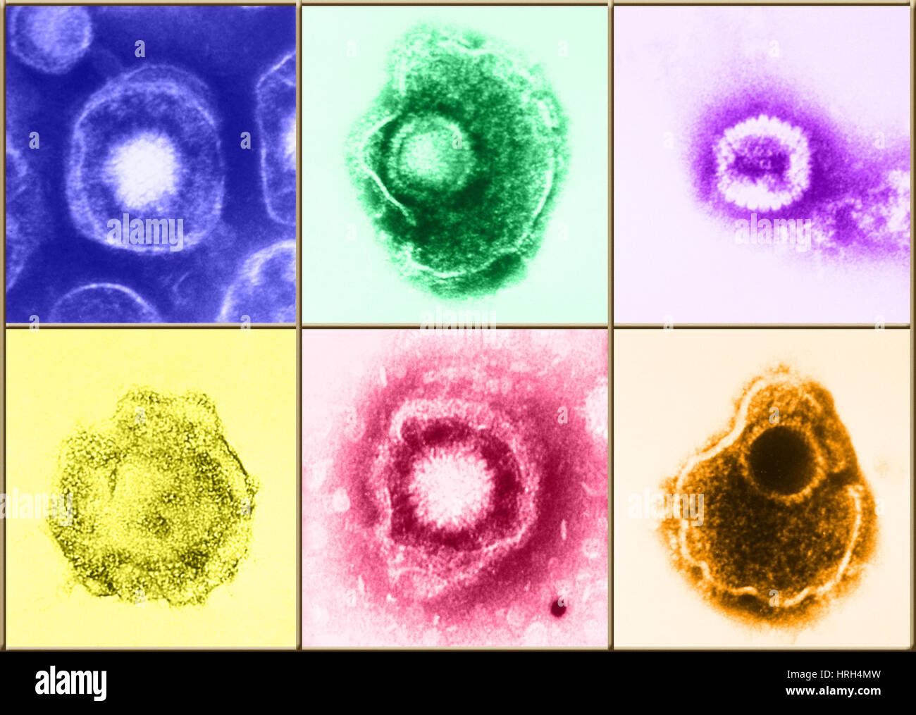 Various forms of herpes simplex virus Stock Photo - Alamy