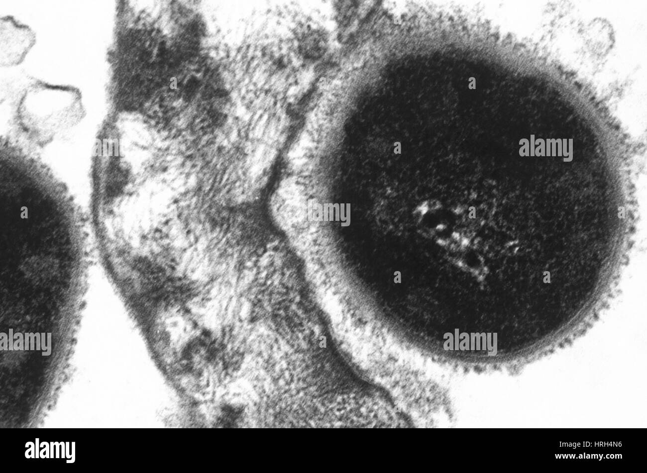 Streptococcus pneumoniae scanning hi-res stock photography and images ...
