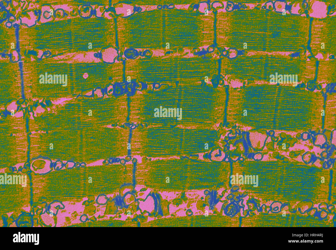 Skeletal muscle micrograph hi-res stock photography and images - Alamy