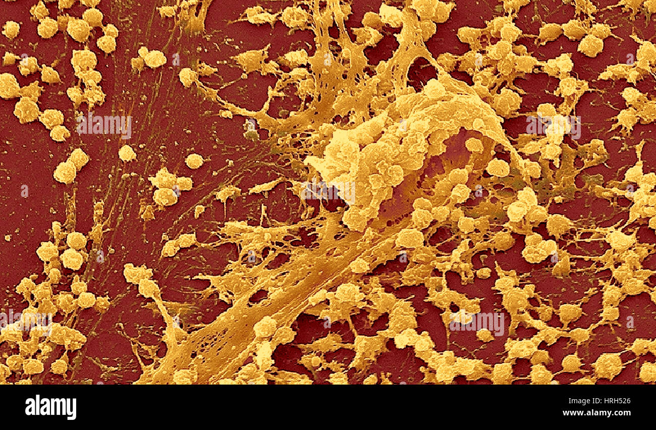 Staphylococcus biofilm Stock Photo - Alamy