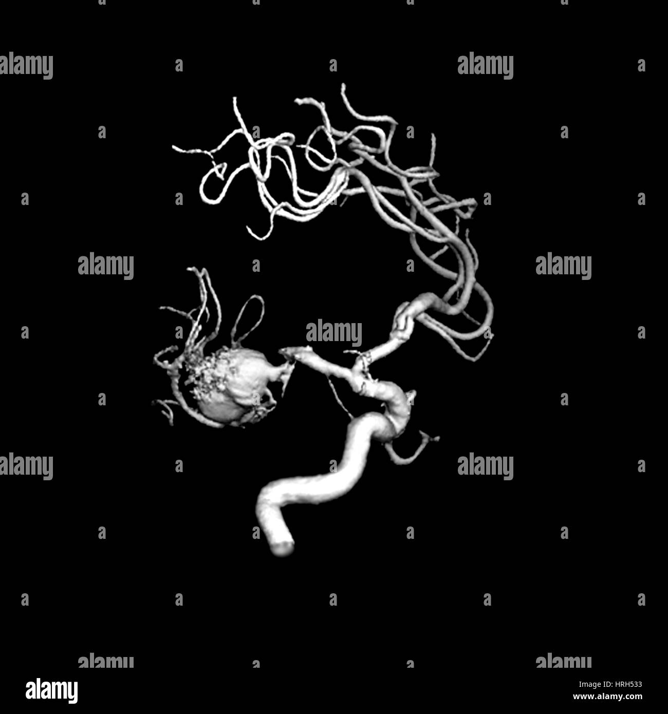 Brain in human brain Black and White Stock Photos & Images - Alamy