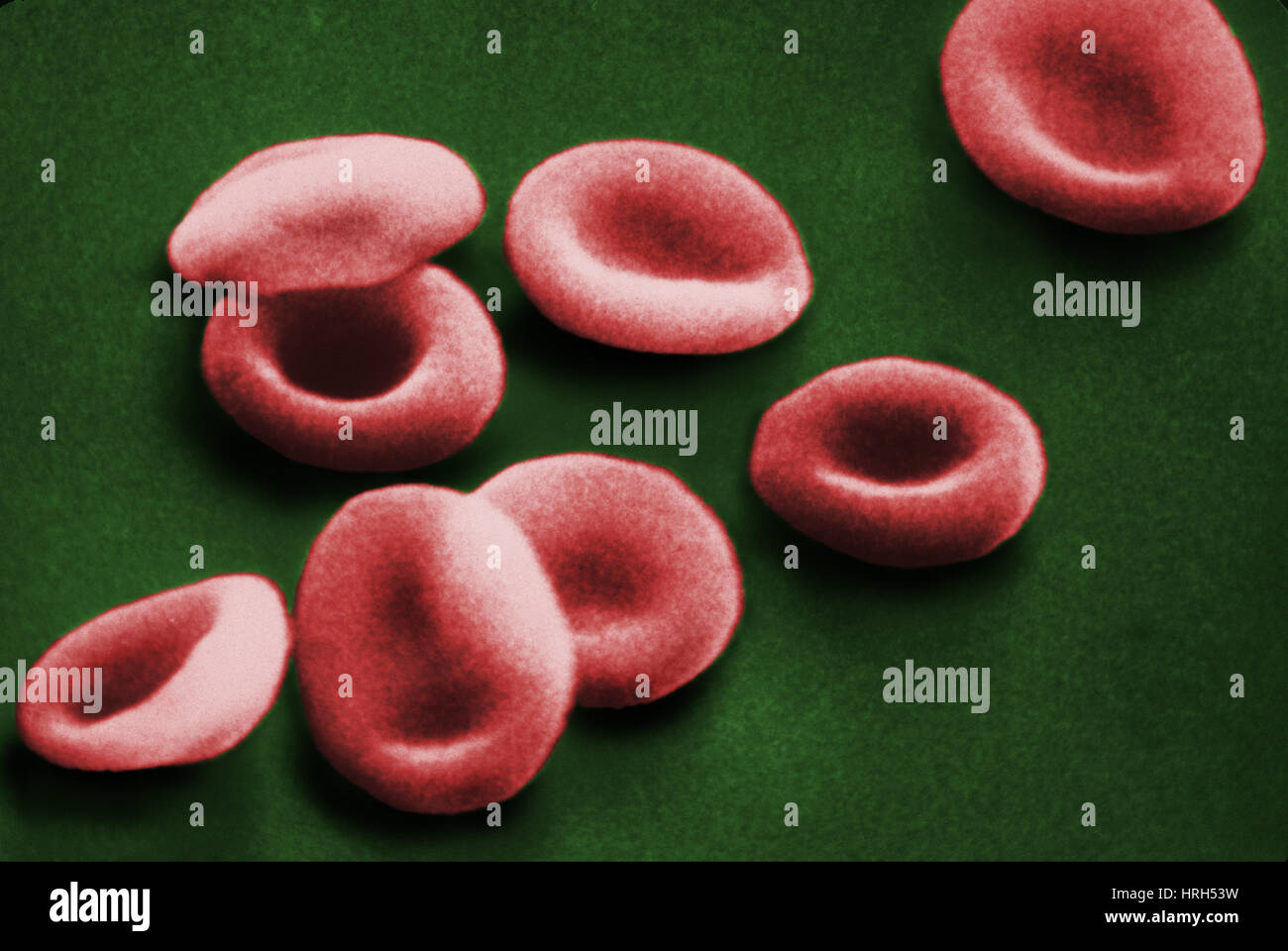 Scanning electron micrograph (sem) immune cells hi-res stock ...