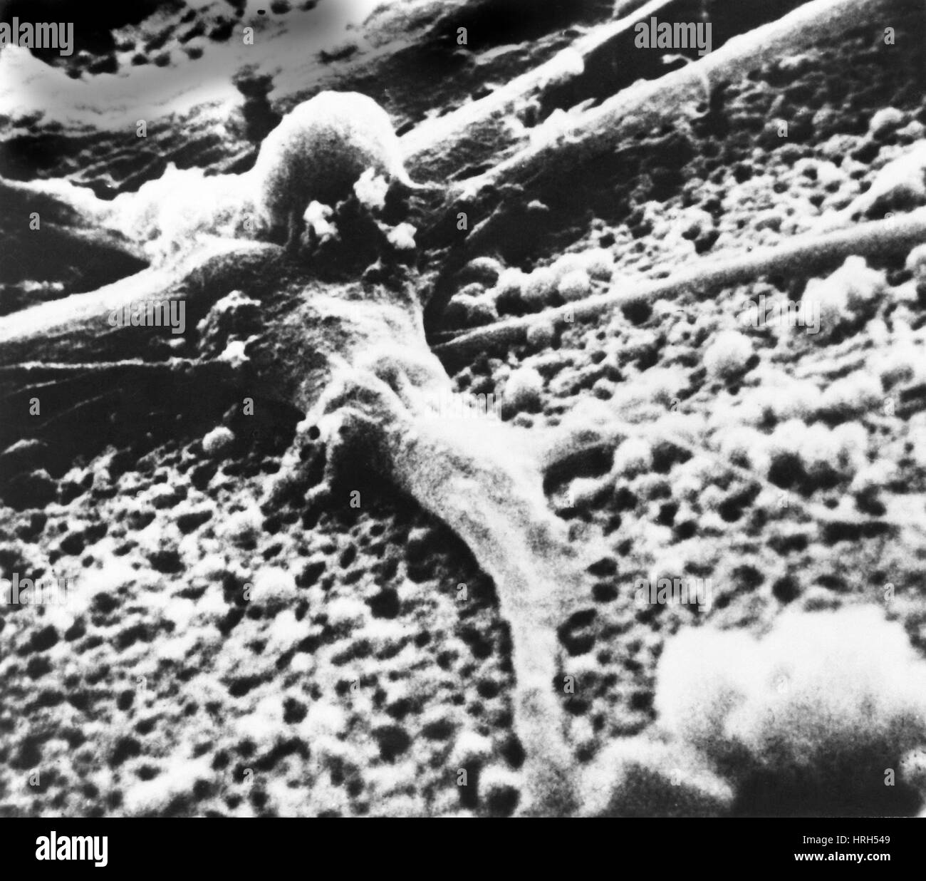 Malignant cancer cell Stock Photo - Alamy