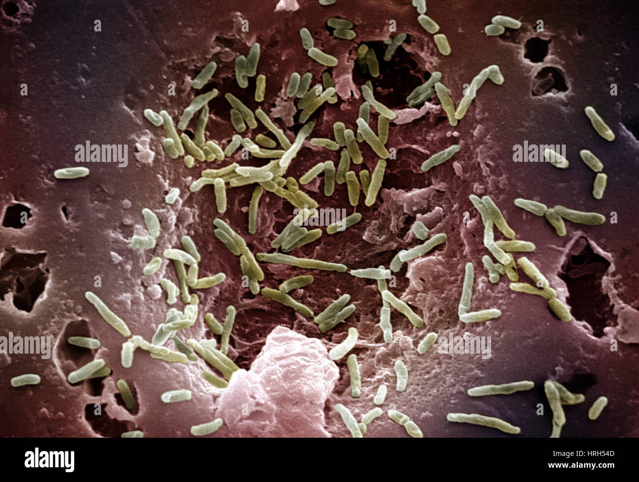 Mycobacterium tuberculosis sem hi-res stock photography and images - Alamy