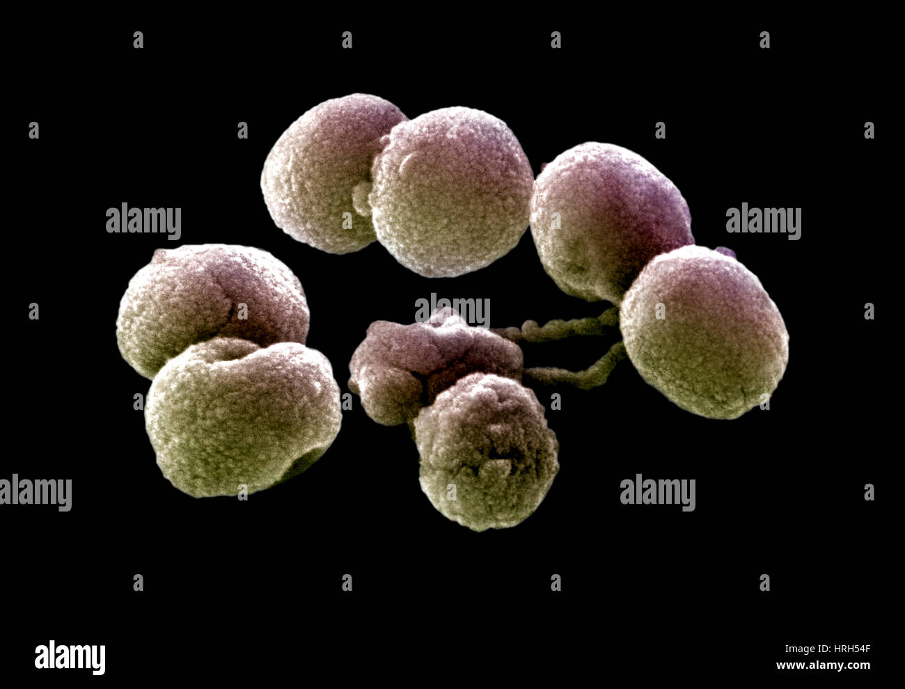 Streptococcus pneumoniae scanning hi-res stock photography and images ...