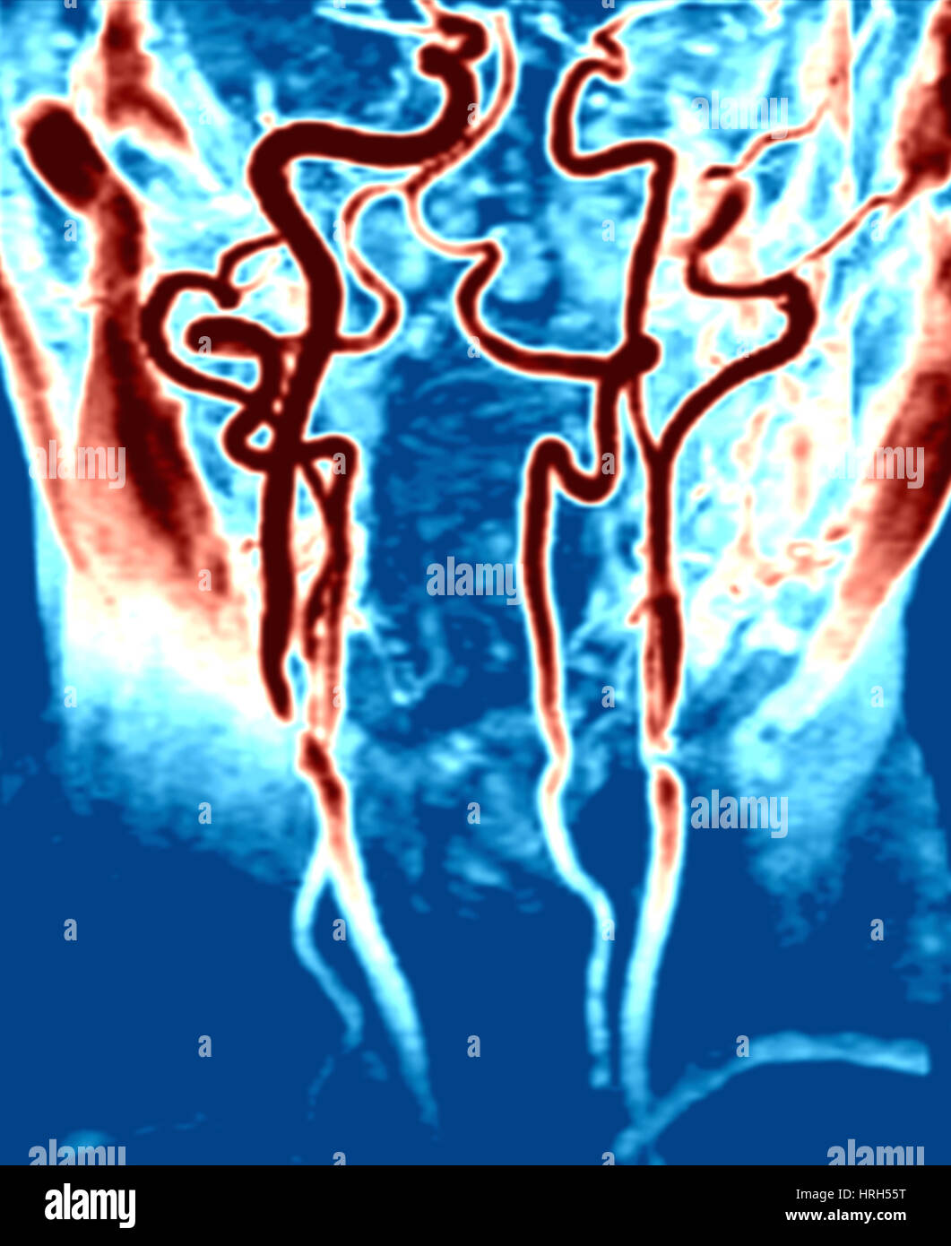 Neck and head arteries hi-res stock photography and images - Alamy