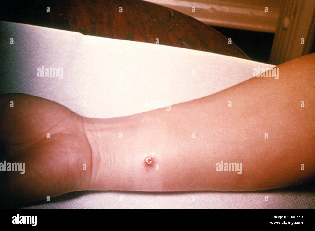 Anthrax bacterium hi-res stock photography and images - Alamy