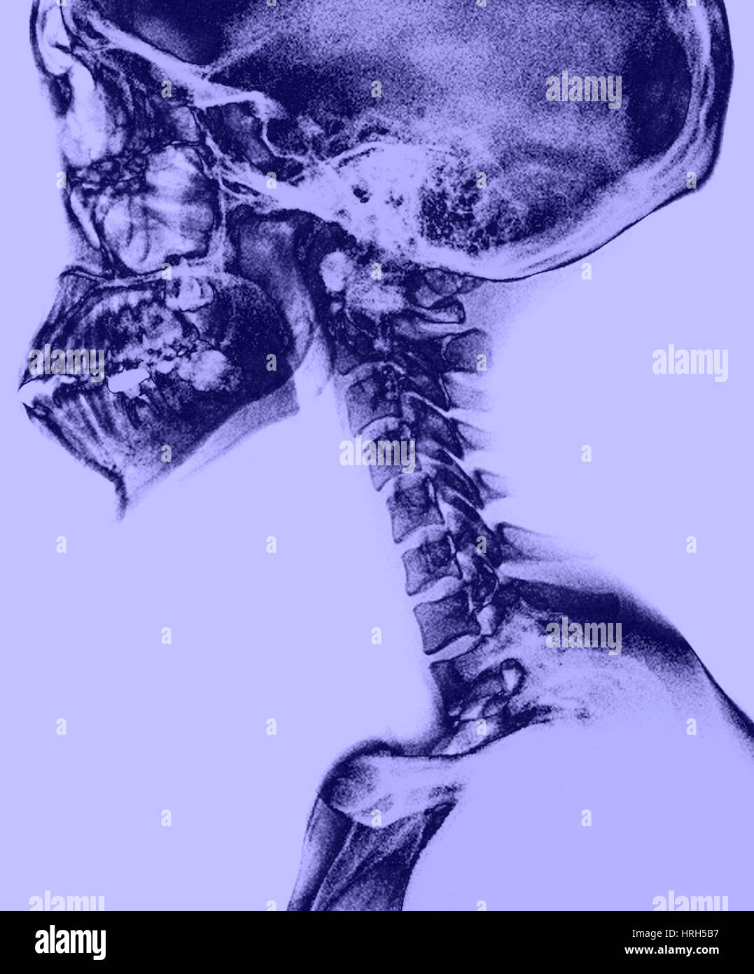 Human Skull and Spine Stock Photo - Alamy