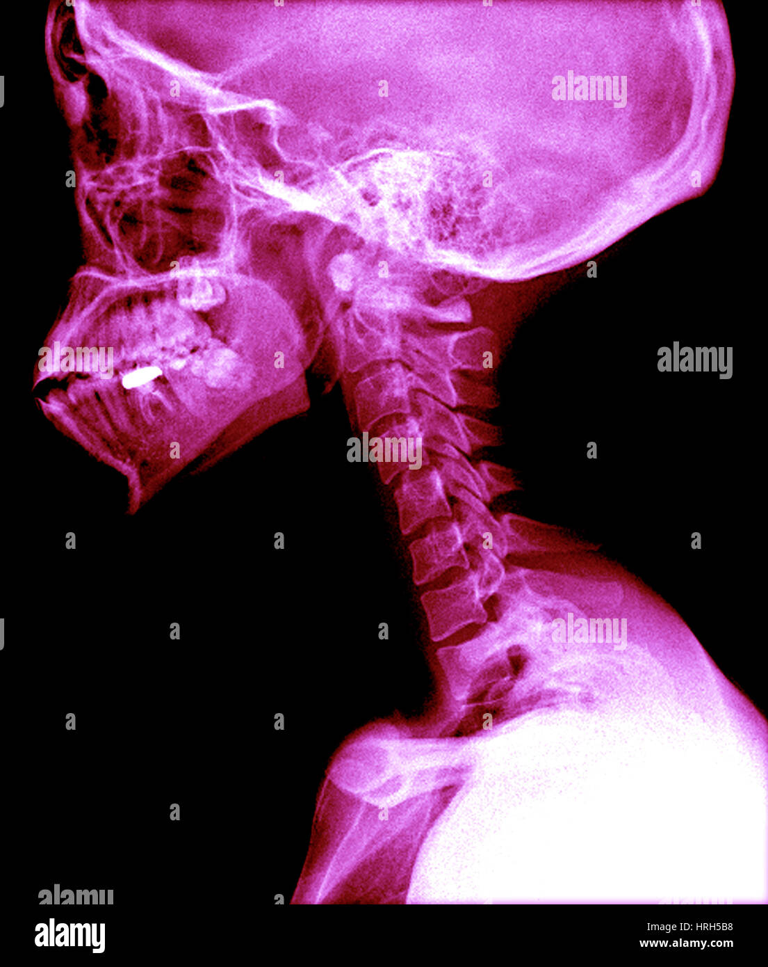 Human Skull and Spine Stock Photo - Alamy