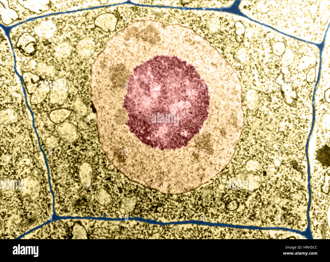 Nucleolus Micrograph