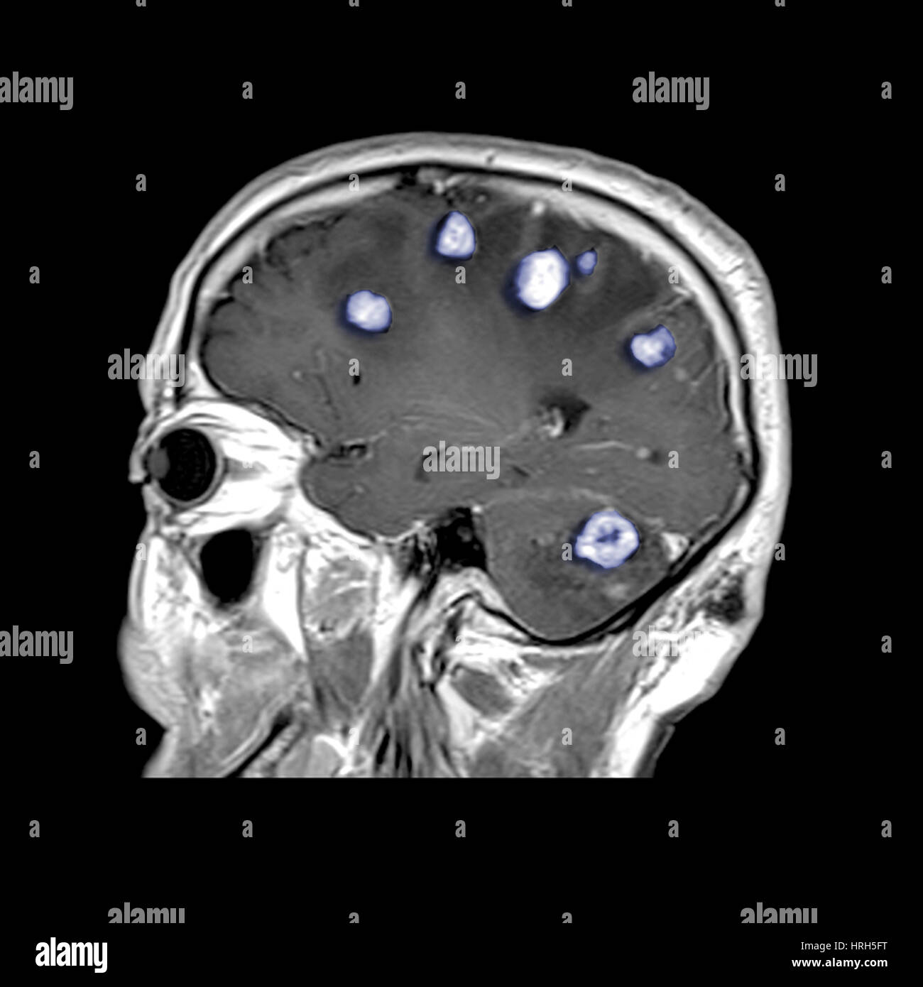 Magnetic resonance images brain mri hi-res stock photography and images ...