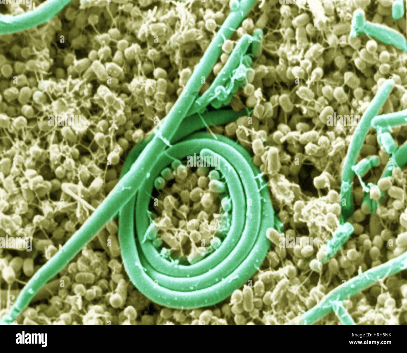 Salmonella enteritidis hi-res stock photography and images - Alamy