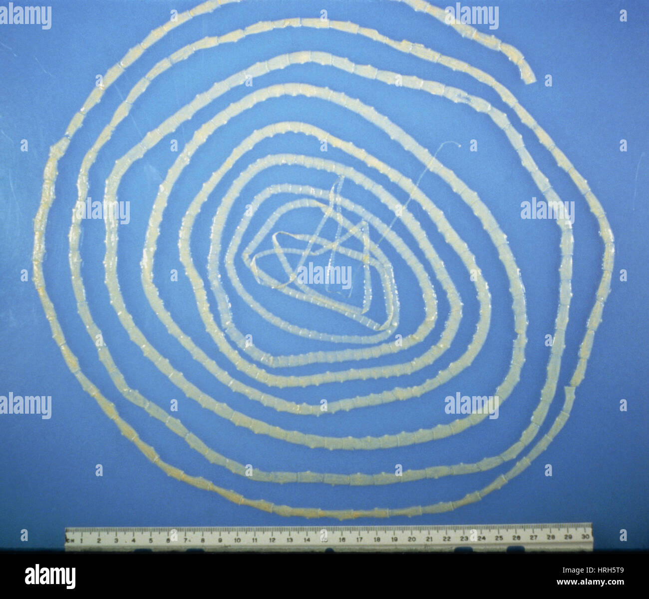 Beef tapeworm taenia saginata hi-res stock photography and images - Alamy