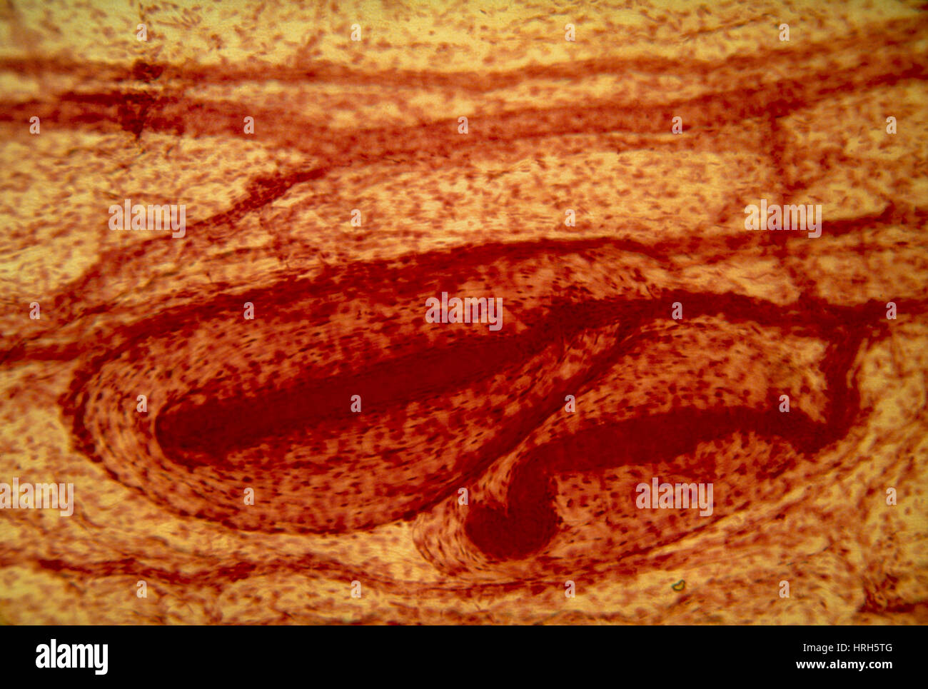 Pacinian Corpuscle High Resolution Stock Photography and Images - Alamy