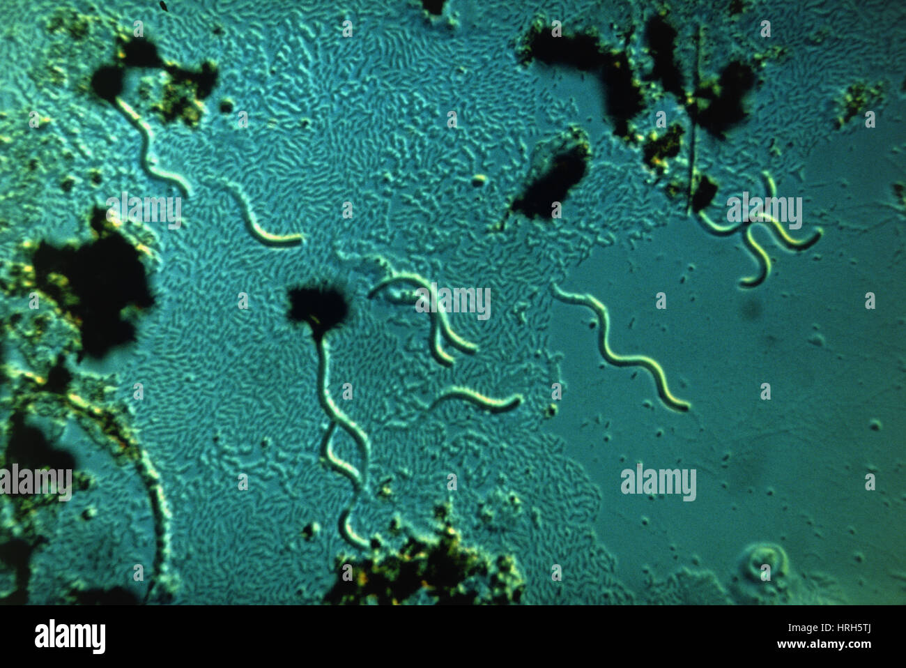 Light micrograph of spirochaetes bacteria Stock Photo - Alamy