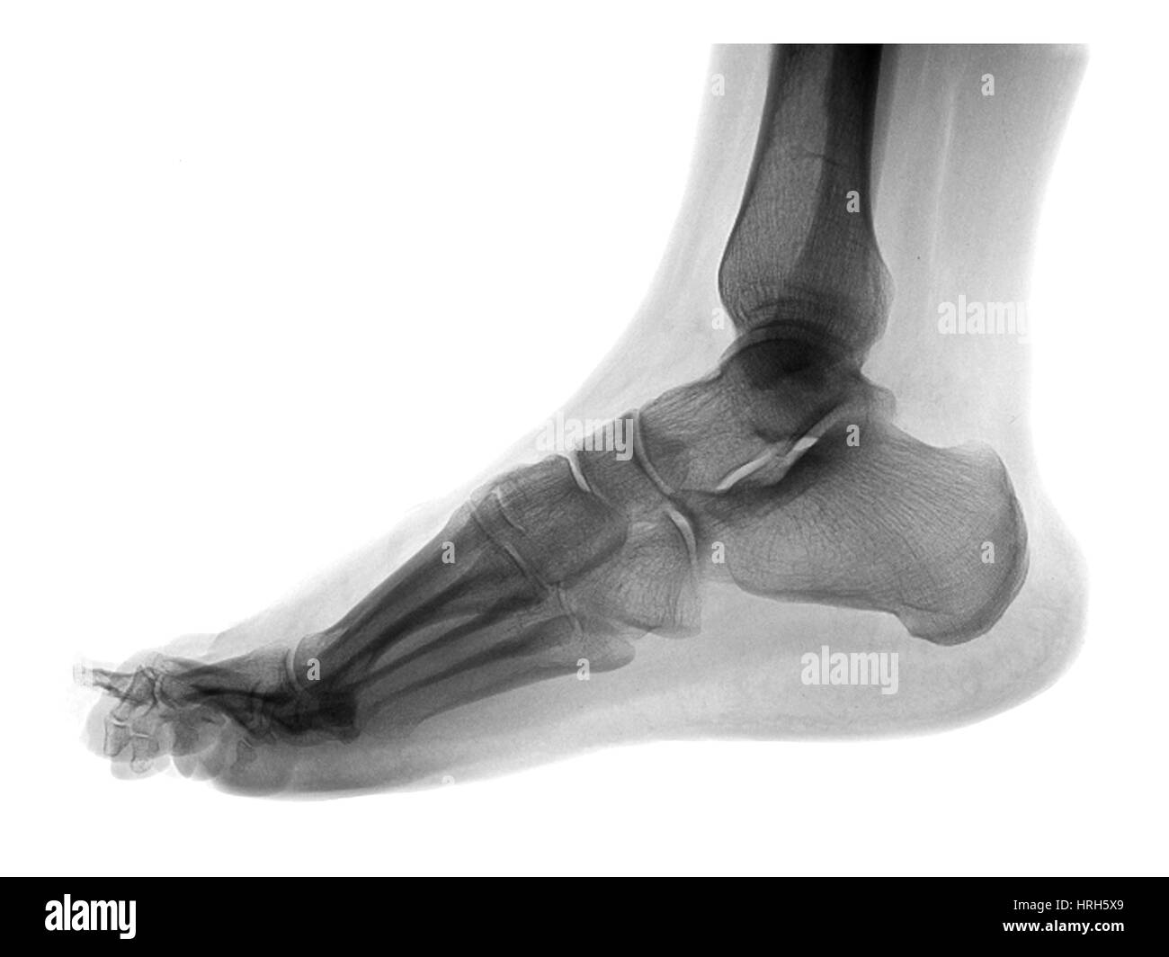 Medical foot Black and White Stock Photos & Images - Alamy