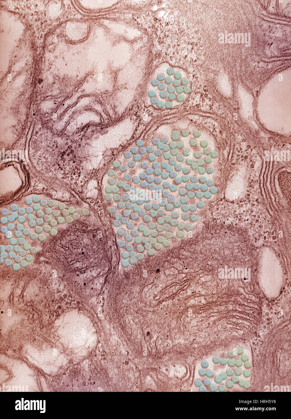 Eastern Equine Encephalitis Virus, TEM Stock Photo - Alamy