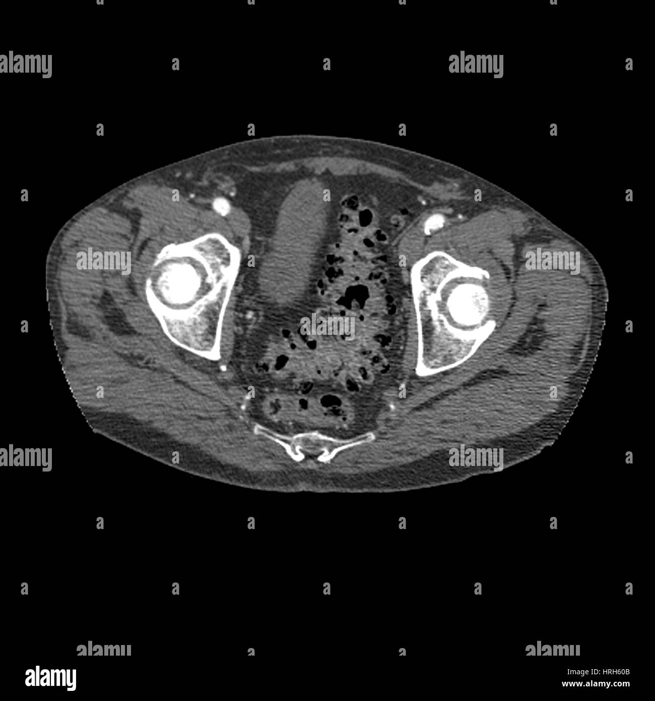 Digestive track cross section Black and White Stock Photos & Images - Alamy