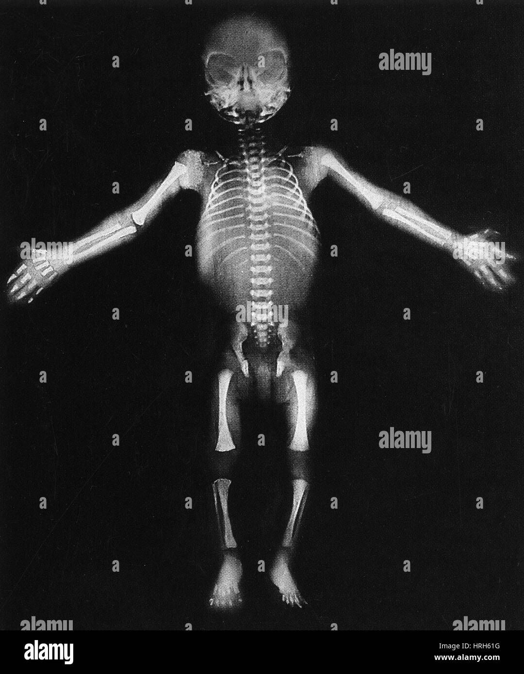Skeleton of a baby Stock Photo - Alamy