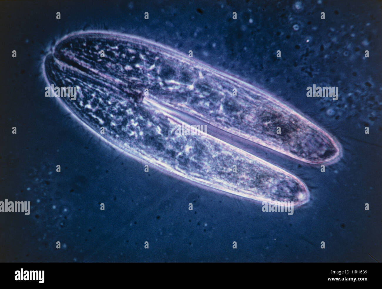 Diagramma Del Blefarisma