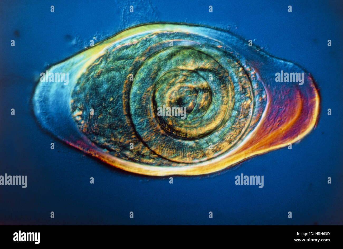 Trichinella spiralis larva, LM Stock Photo - Alamy