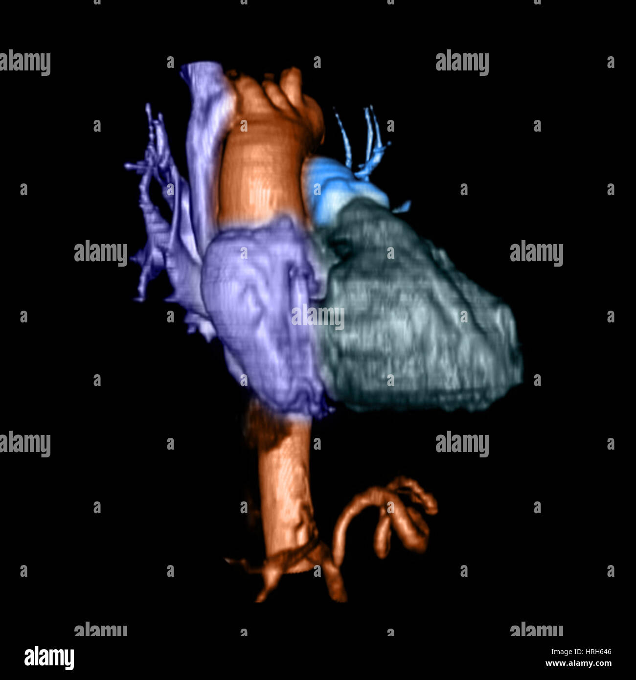 Enhanced 3d cta hi-res stock photography and images - Alamy