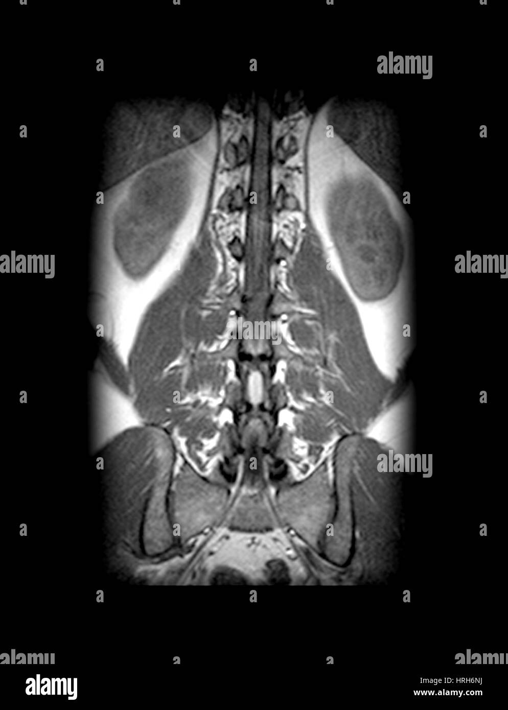 Mri Back Pain Stock Photos & Mri Back Pain Stock Images - Alamy