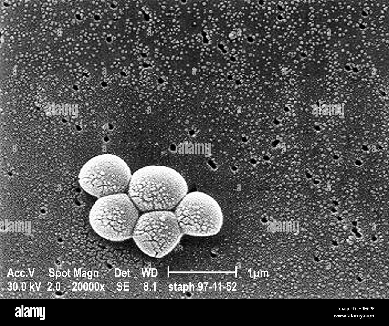 Staph aureus hi-res stock photography and images - Alamy