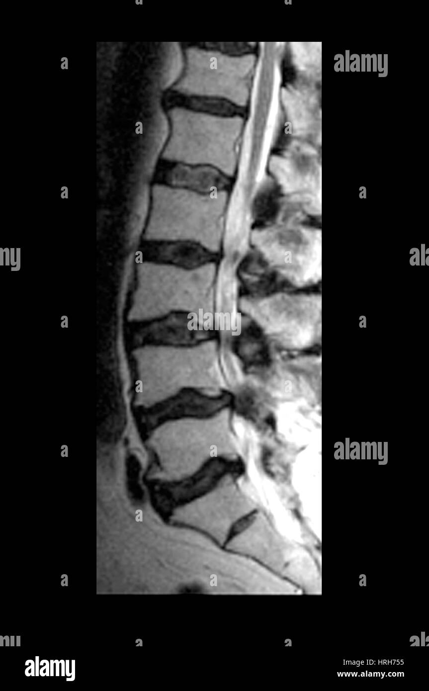 Severe we Black and White Stock Photos & Images - Alamy