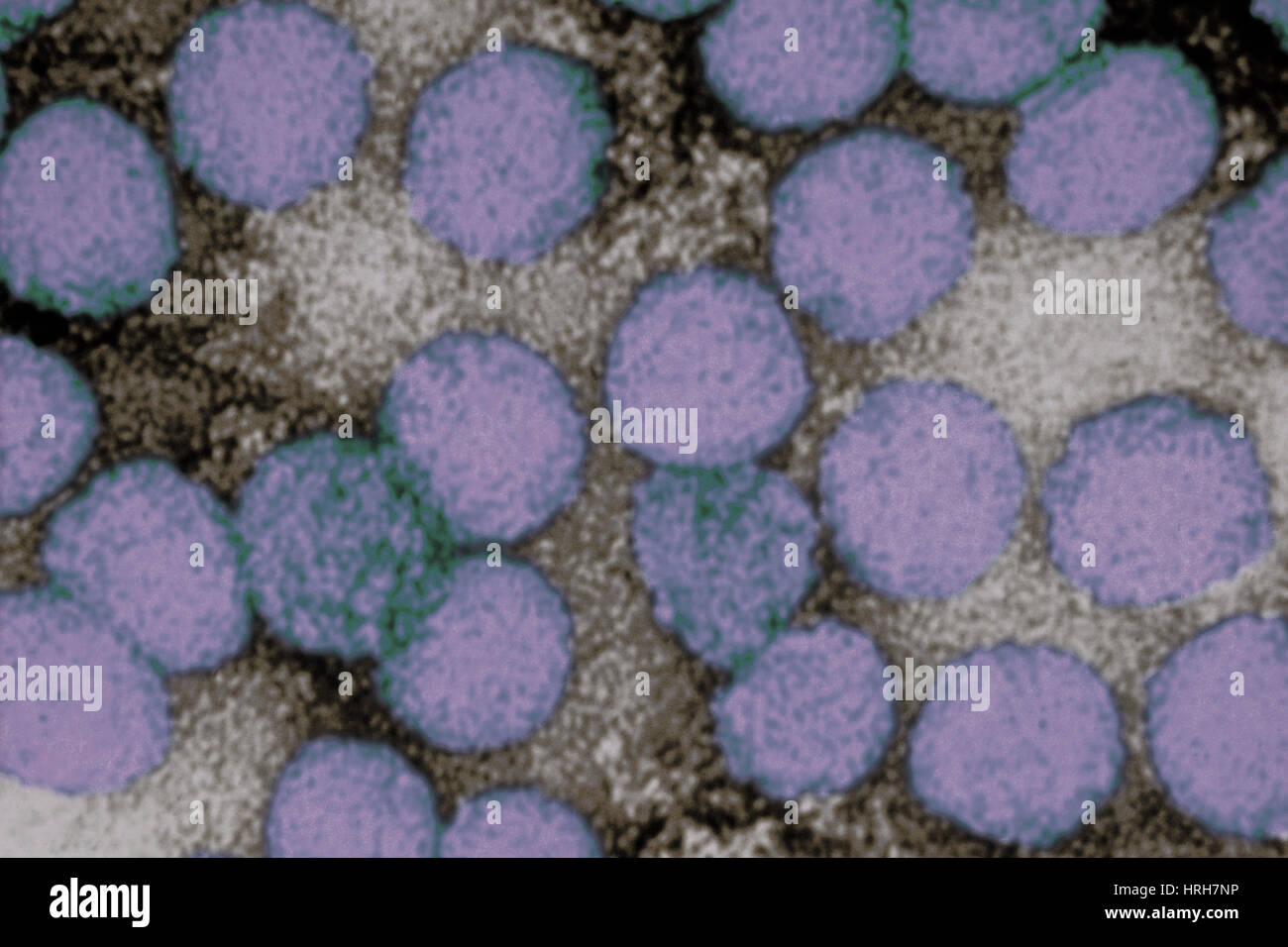 Yellow Fever Virus, TEM Stock Photo - Alamy