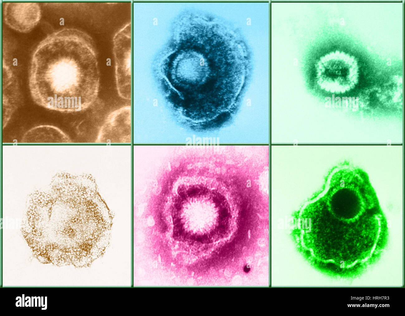 Herpes simplex virus type 1 hi-res stock photography and images - Alamy