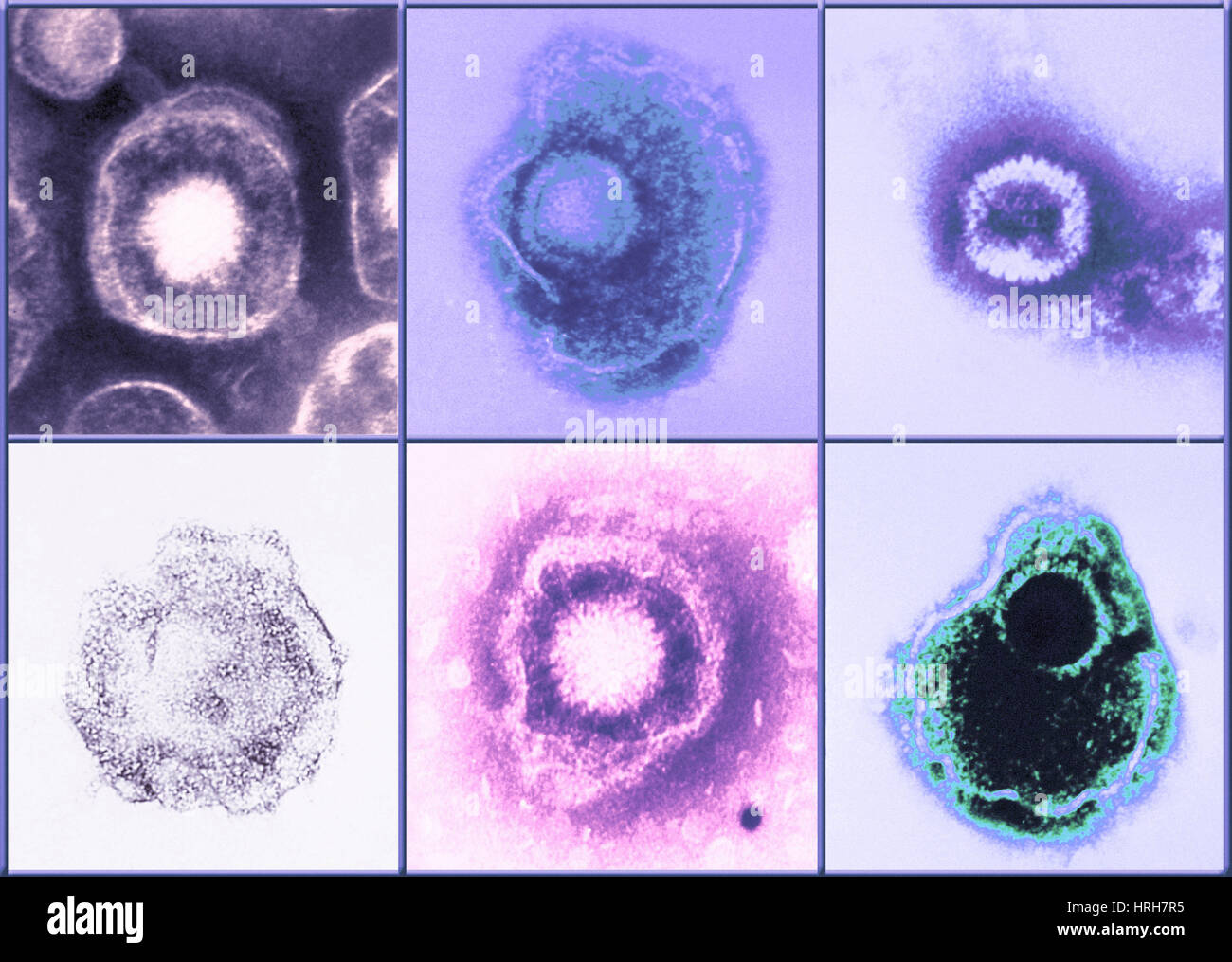 Herpes simplex virus 2 hi-res stock photography and images - Alamy