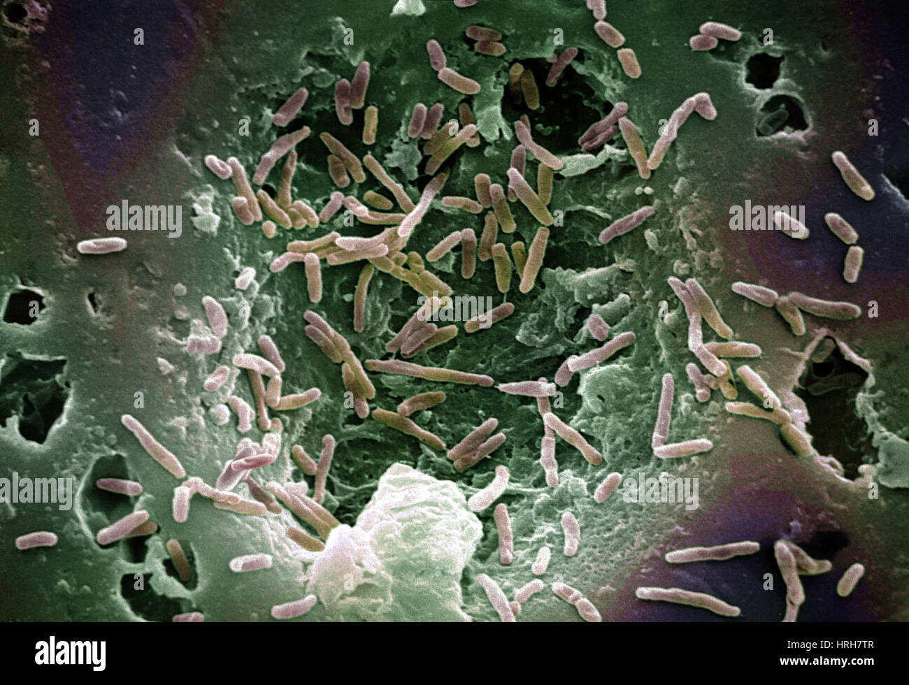 Mycobacterium tuberculosis sem hi-res stock photography and images - Alamy