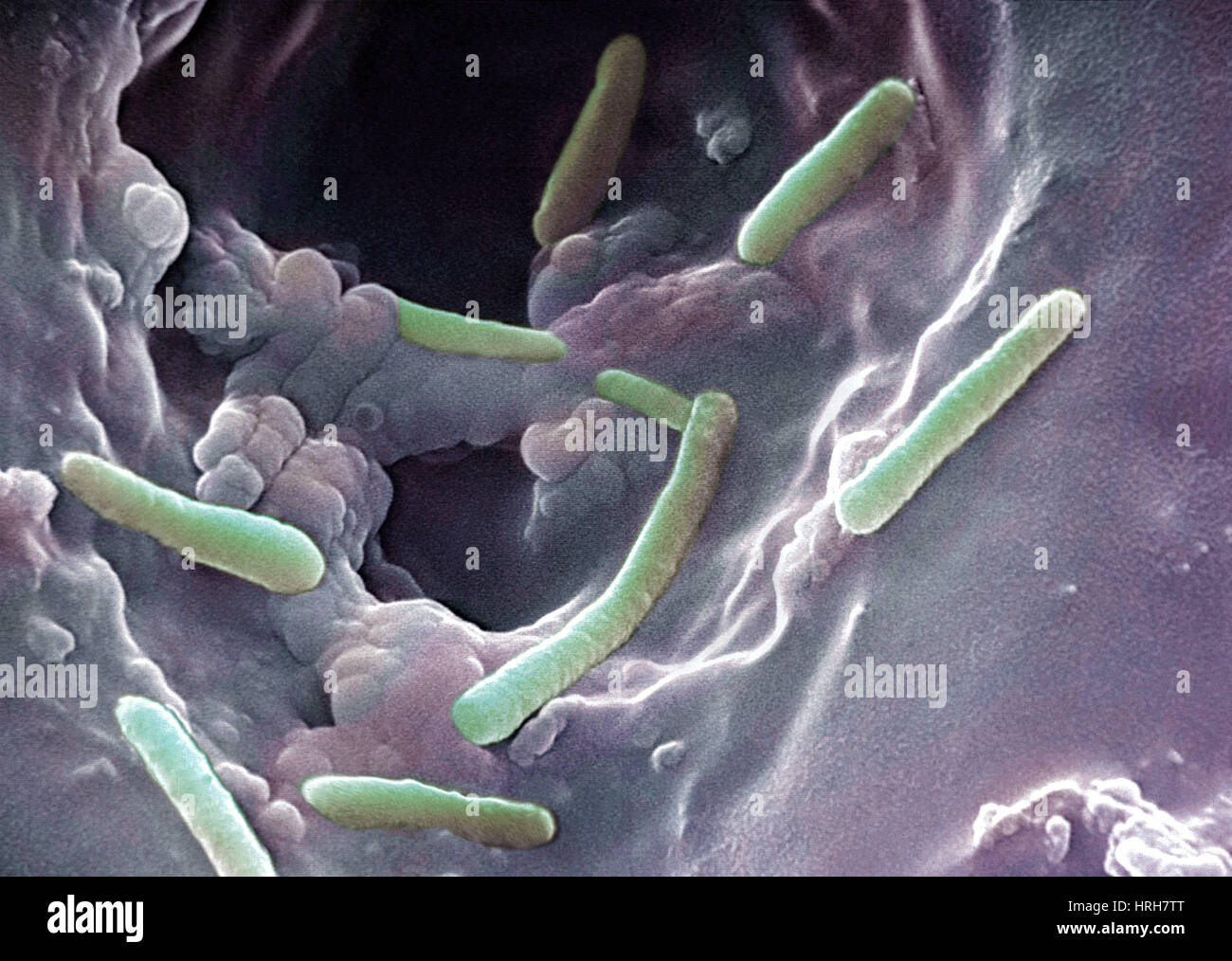 Pseudomonas aeruginosa hi-res stock photography and images - Alamy