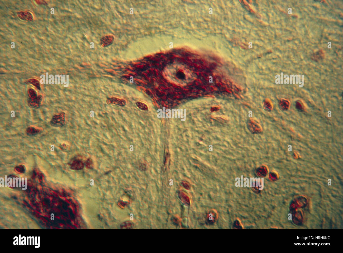 Micrograph of human nerve cell hi-res stock photography and images - Alamy
