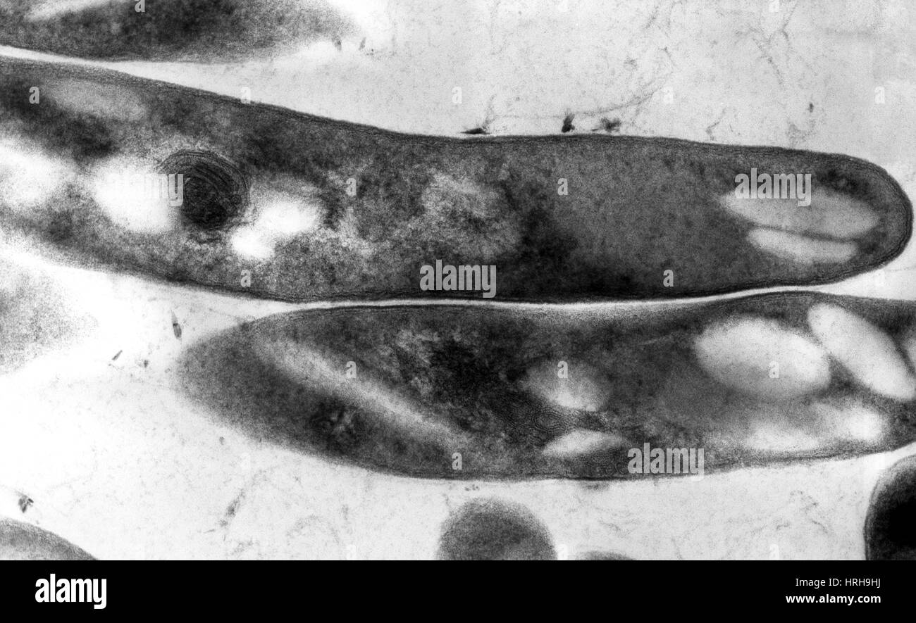 Mycobacterium tuberculosis micrograph Black and White Stock Photos ...