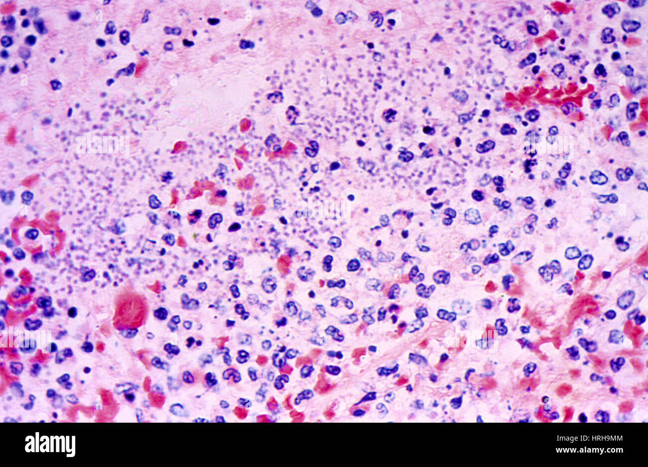 Plague Bacteria Yersinia Pestis Stock Photos & Plague Bacteria Yersinia ...