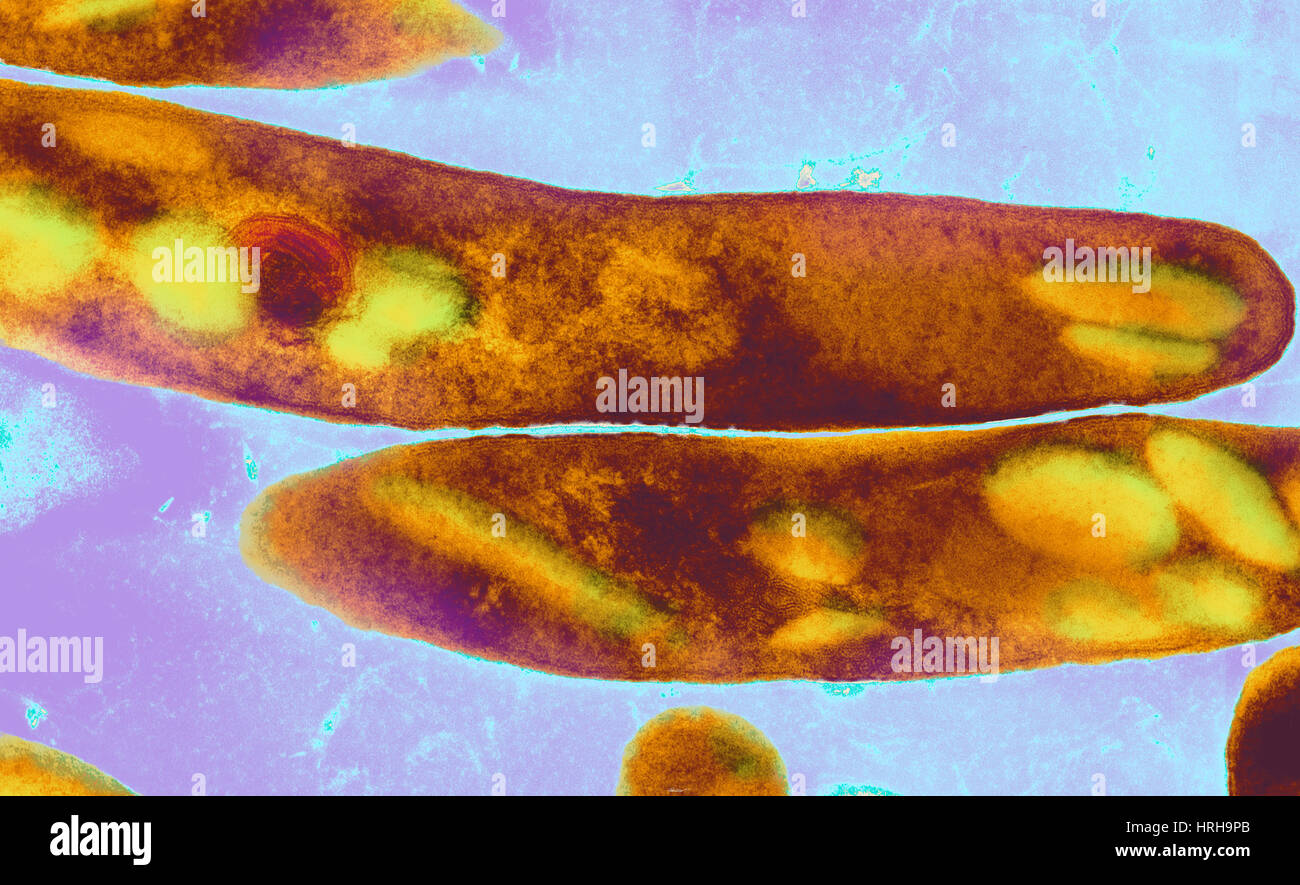 Bacilli tuberculosis hi-res stock photography and images - Alamy