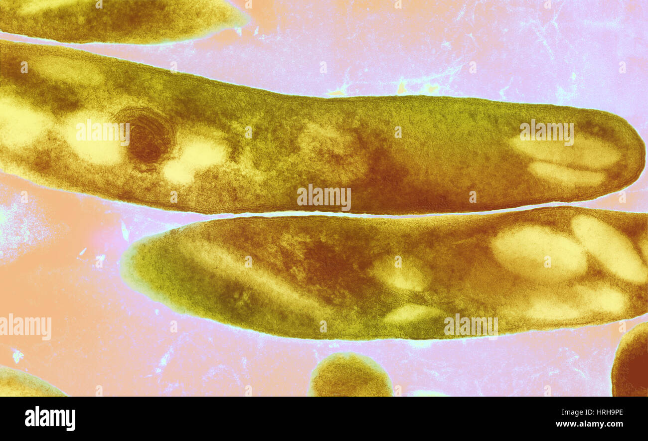 Mycobacterium Tuberculosis Micrograph High Resolution Stock Photography and Images - Alamy