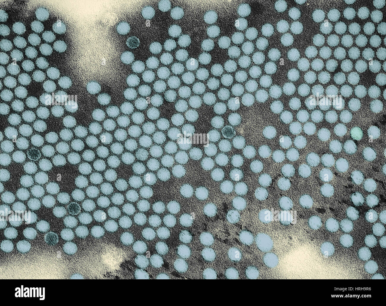 Polio virus micrograph hi-res stock photography and images - Alamy