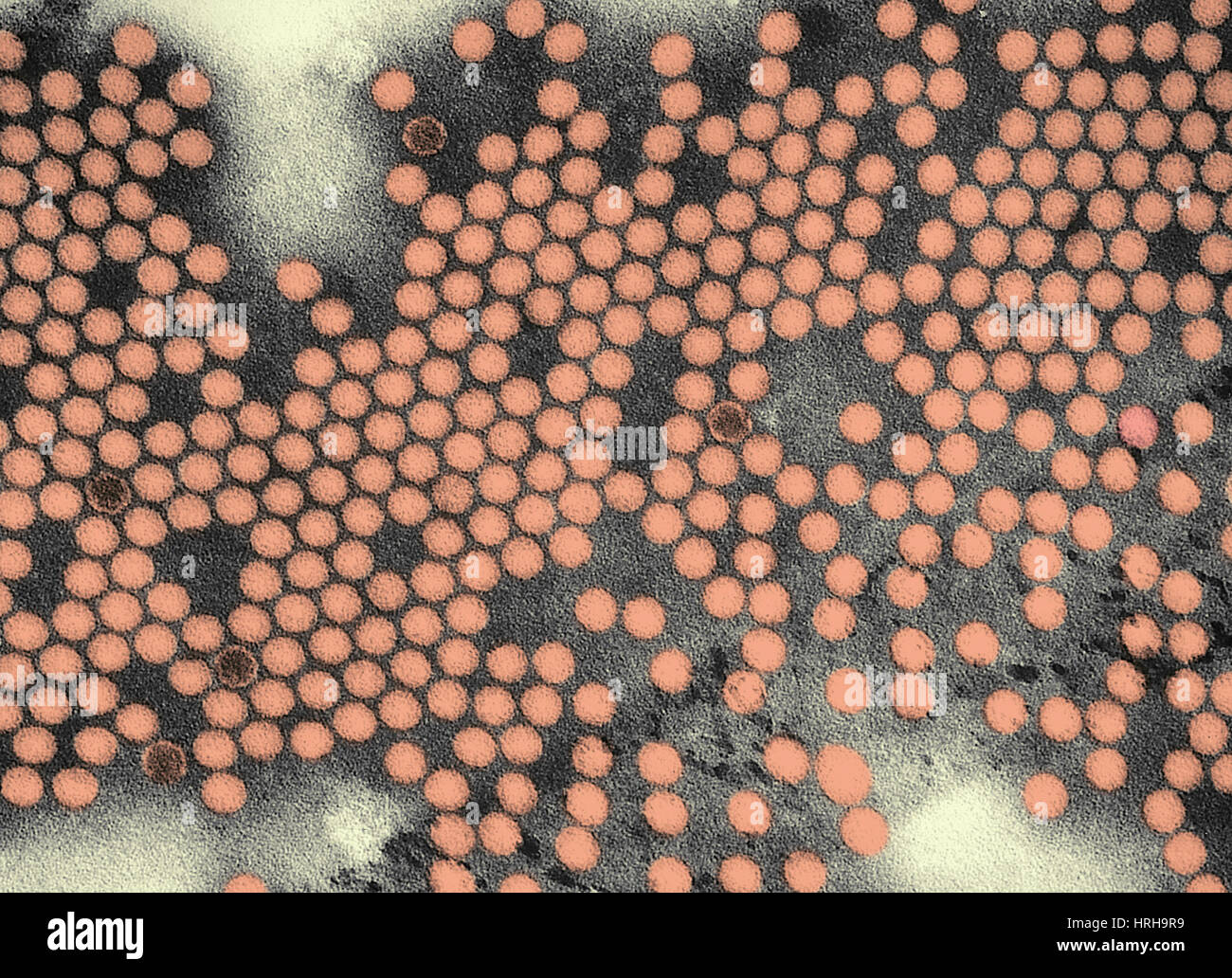 Polio virus microscope hi-res stock photography and images - Alamy