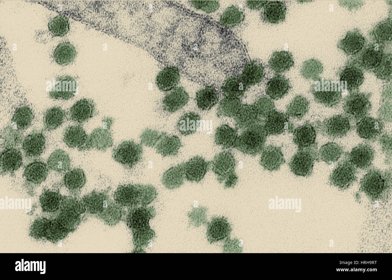 West nile virus electron microscopy hi-res stock photography and images ...