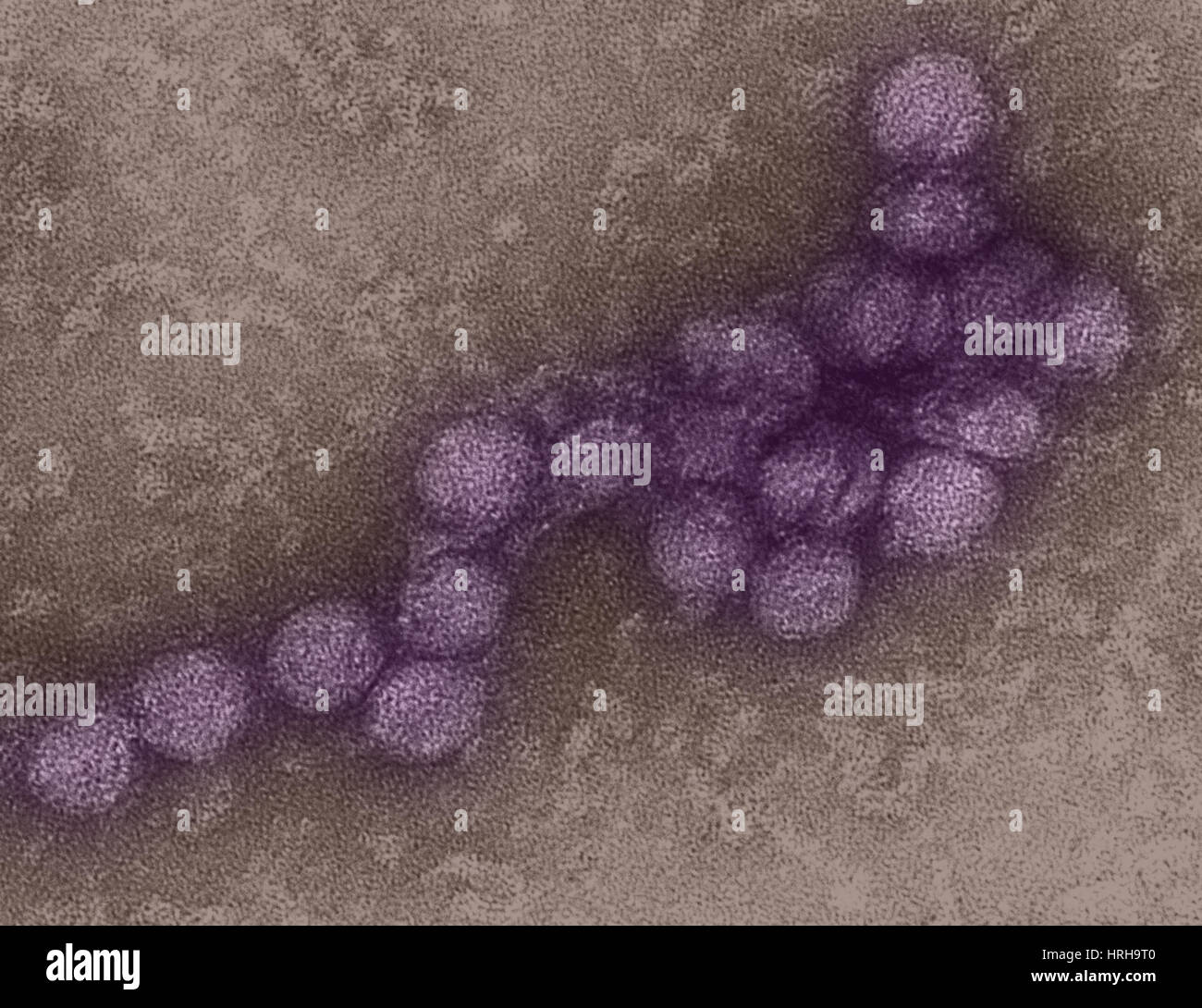 West nile virus infectious disease hi-res stock photography and images ...