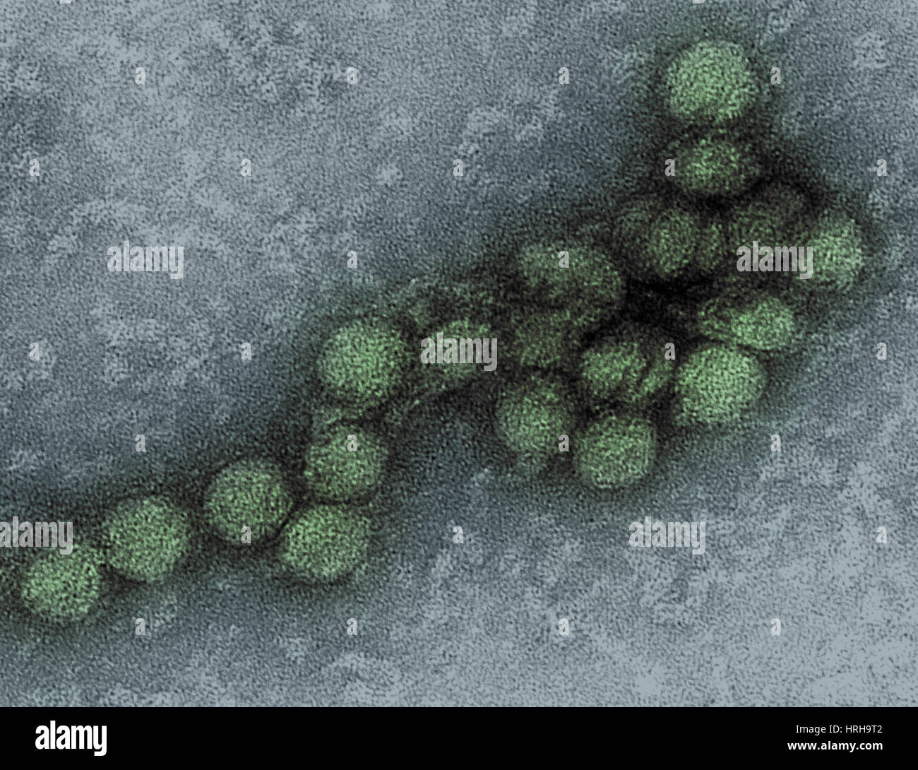West Nile Virus, TEM Stock Photo - Alamy