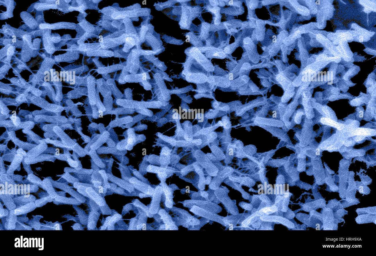 Clostridium difficile associated diarrhea hi-res stock photography and ...