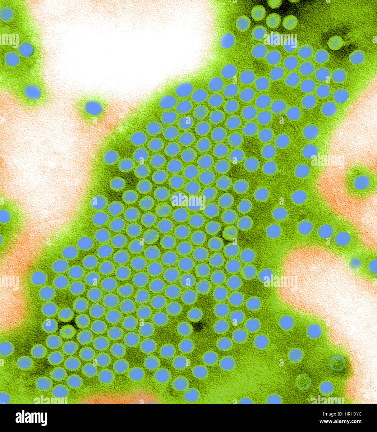 Polio virus micrograph hi-res stock photography and images - Alamy