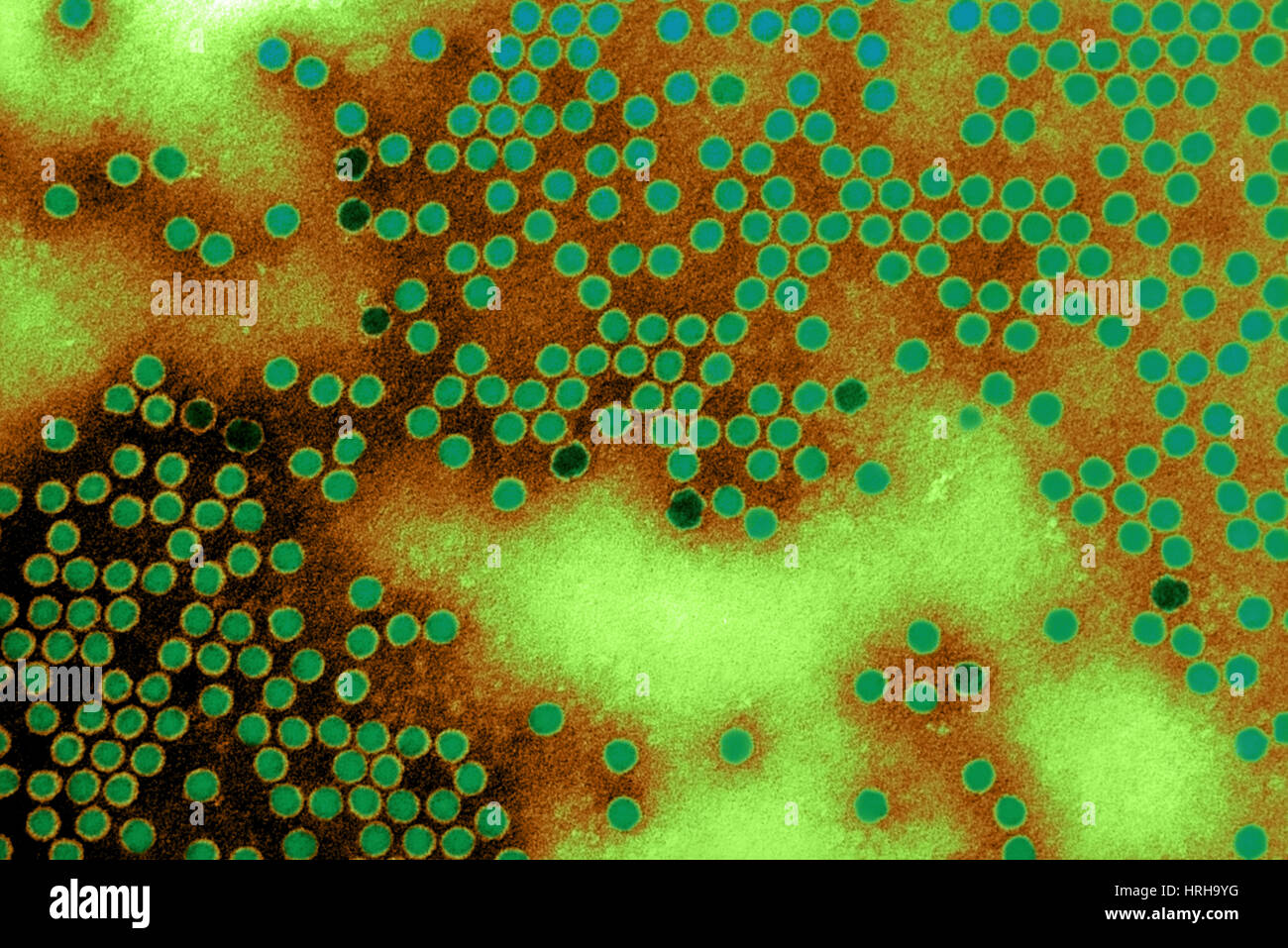Polio virus microscope hi-res stock photography and images - Alamy